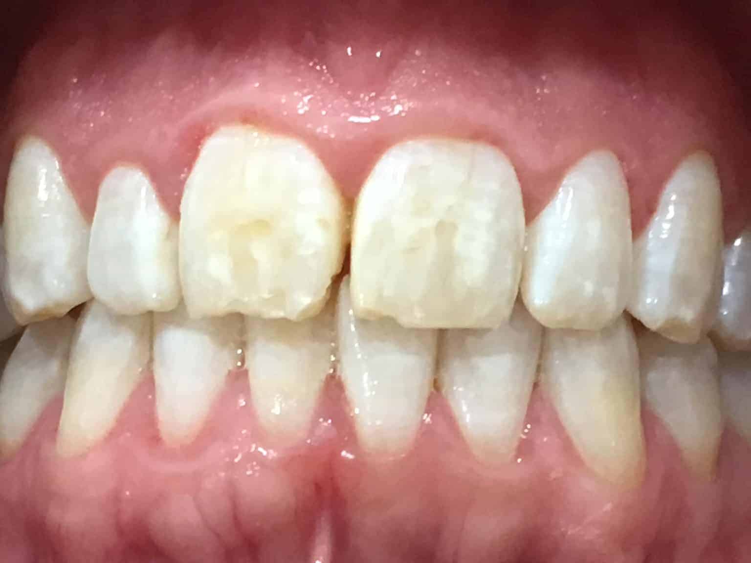 Gallery - Murdoch Dental & Implant Centre