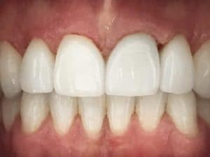 Gallery - Murdoch Dental